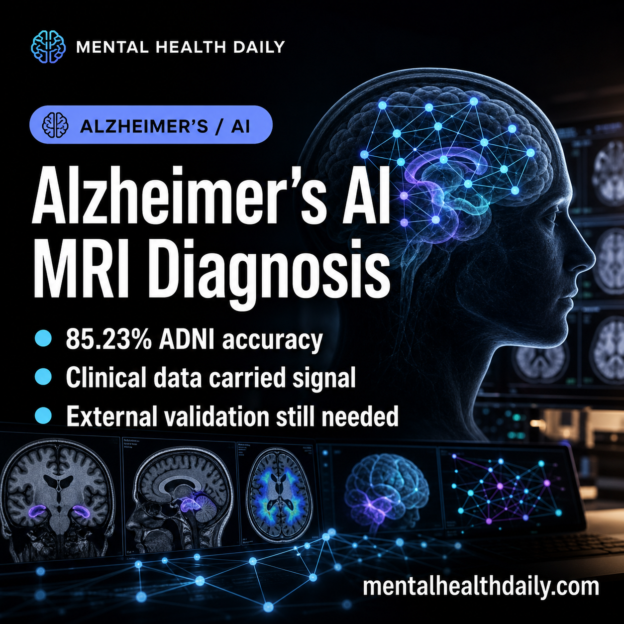 Alzheimer's AI MRI Diagnosis: ANA-GNN Reaches 85.23% Accuracy in ADNI ...