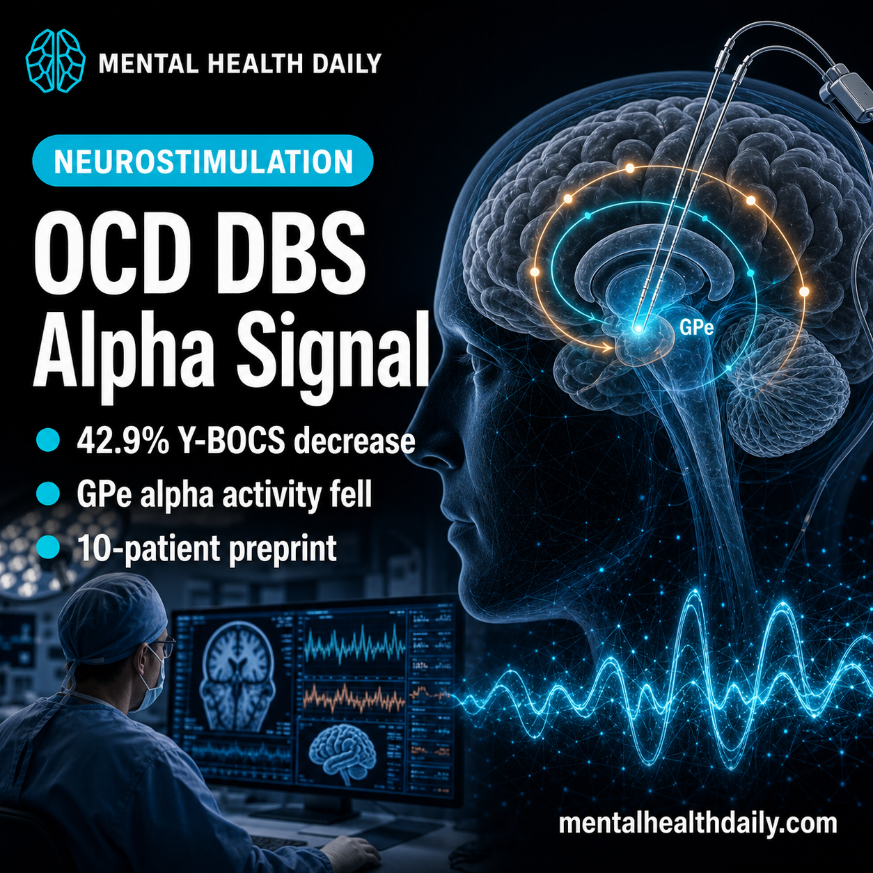 OCD DBS Reduced Y-BOCS 42.9% as GPe Alpha Activity Decreased ...
